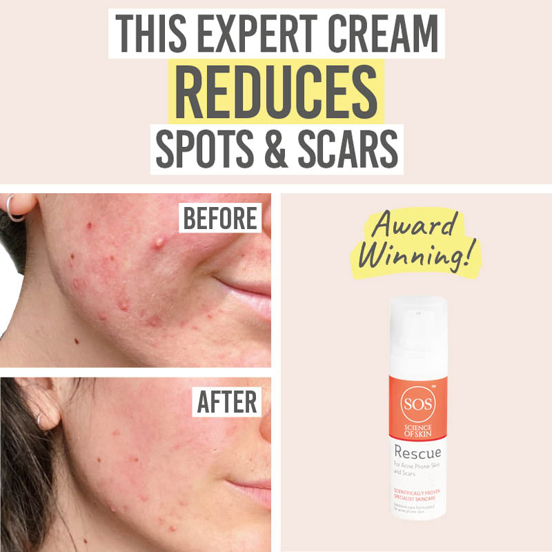 Science of Skin Rescue | Spot & Scar Cream – Beauty and the Boutique
