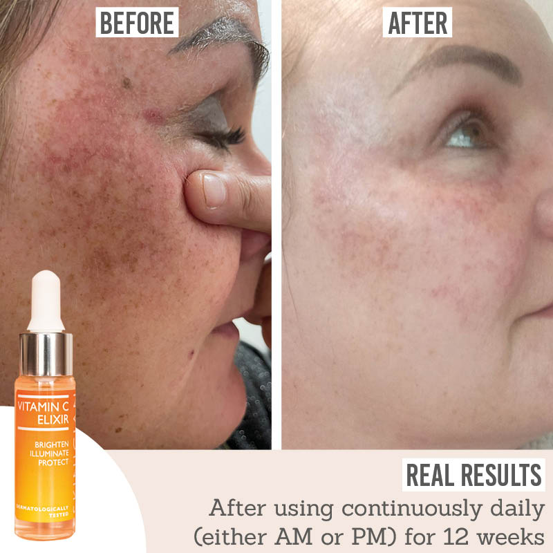 Skinician Vitamin C Elixir | Brighter Skin – Beauty and the Boutique